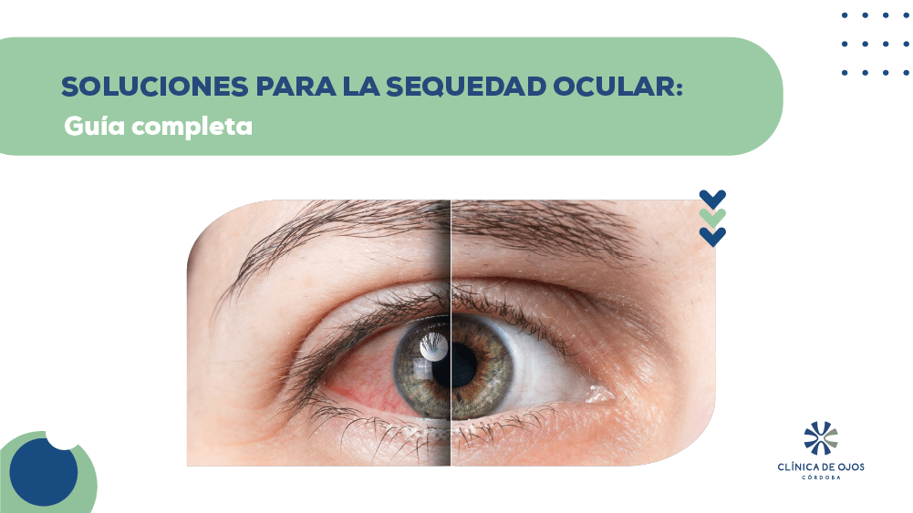 Sequedad ocular. Causas, síntomas y tratamientos - Clínica de Ojos Córdoba
